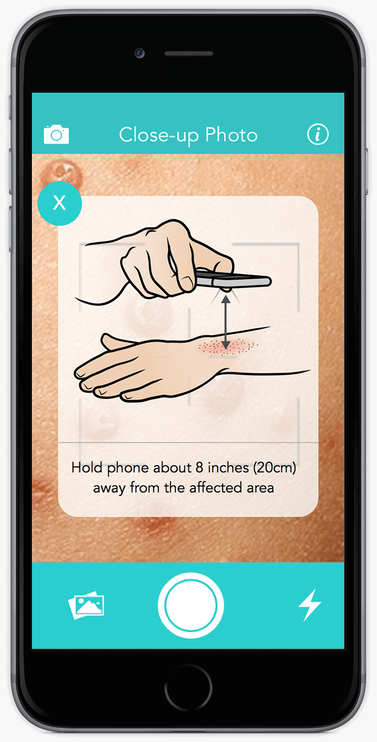 How it Works - First Derm, Ask an Online Dermatologist on any skin concern