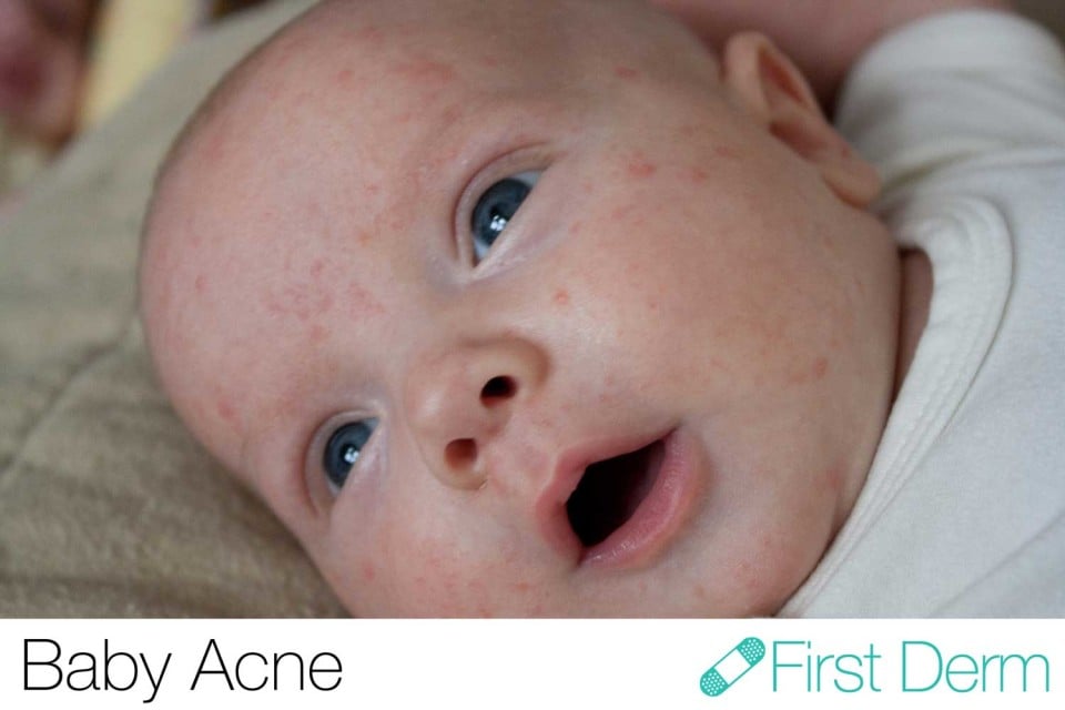 Skin Care Advice For Your Newborn Baby