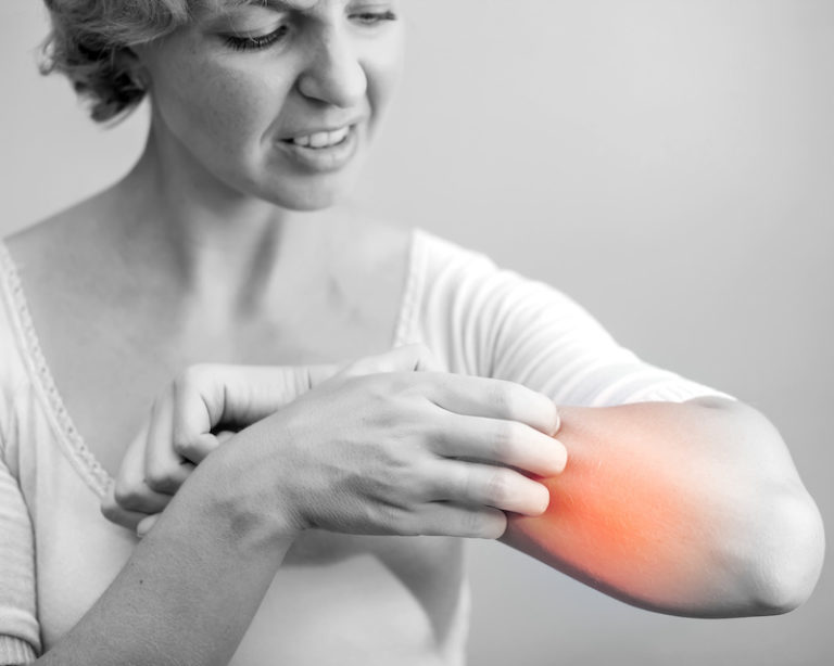 Why Do We Itch? - Online Dermatology