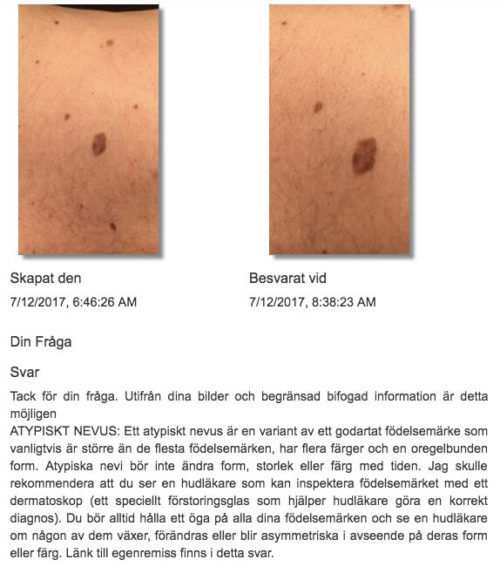 How Our First Derm App Can Save Your Life