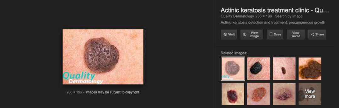 Skin Image Search™ better than an Internet search